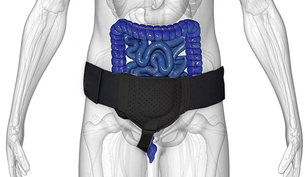 Free Size Hernia Belt - Support & Pain Relief for Inguinal Sports Hernia