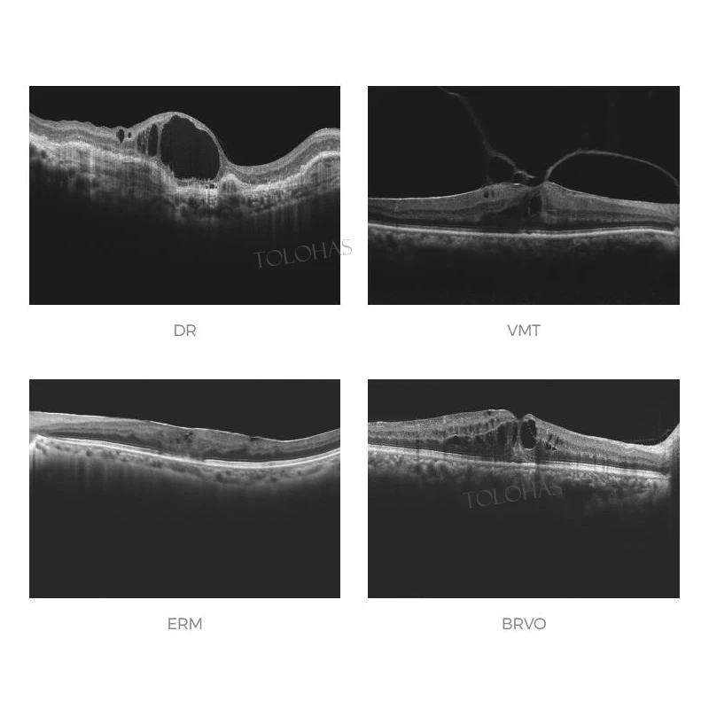 Lhvm3 Ophthalmic Professional Automatic Optical Coherence Tomography ...