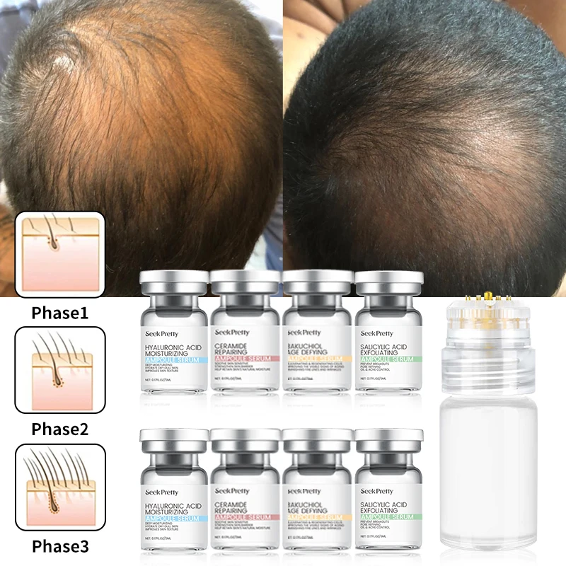 Professional Micro Needling Ampoules Microinfusion System Dermalheal ...