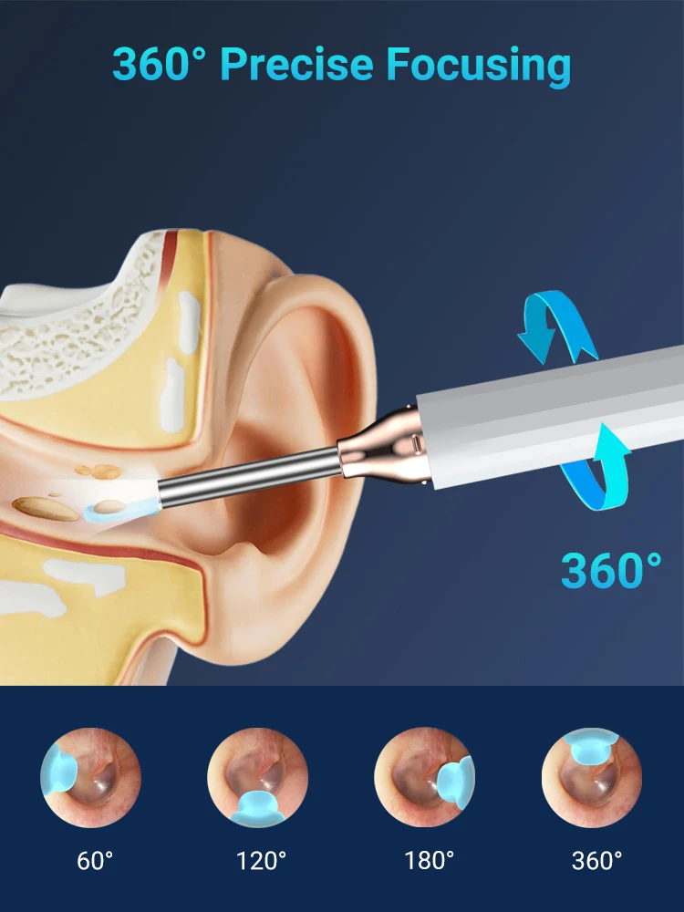 Wireless Visual Ear Cleaning - Mini Ear Spoon Cleaner