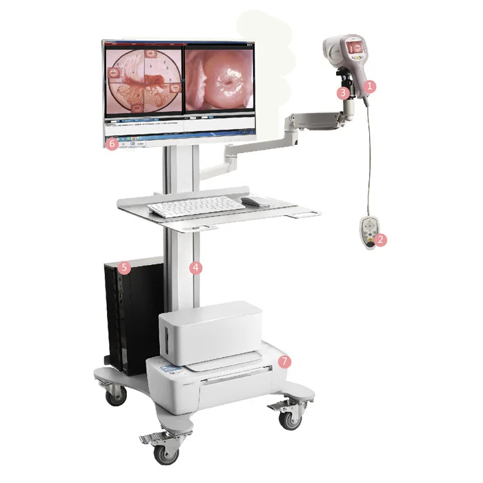 Gynecological Colposcope Kernel KN-2200I - Digital Imaging