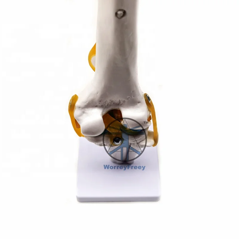 Medical Spine Endoscope Endoscopic Spine Surgery Teaching Model ...