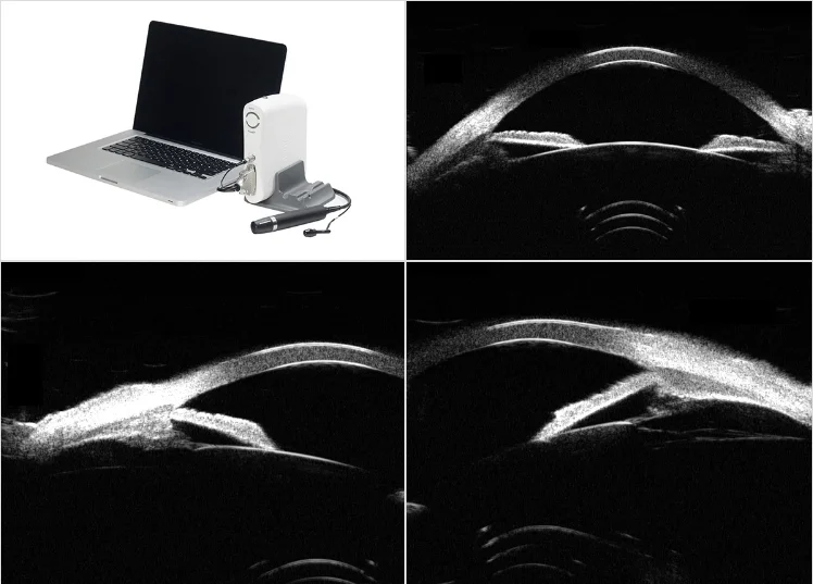 SW-3200 Ultrasound Biomicroscope - Panoramic UBM for Glasses Shop