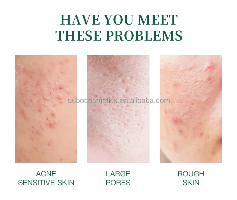 Kormesic Private Label Skincare Facial Cleaning Exfoliating Pads Anti ...