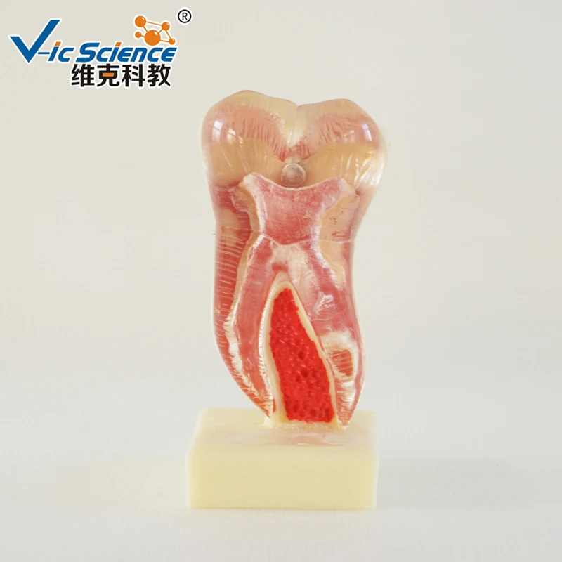 6times Anatomic Profile Model Of Mandibular Molar The Results Showed ...