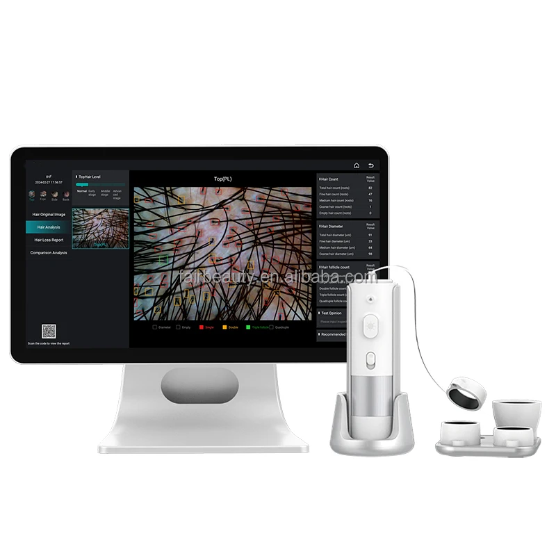 Professional Handheld Scalp Scanner - HD Hair Follicles Detector