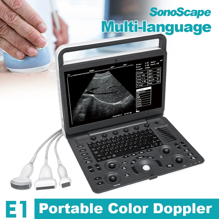 Alibaba.com: Sonoscape E1 E2 4D ultrasound machines with CE, BV, ISO ...