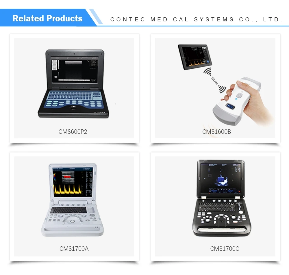 Contec Cms1700a System Machine Portable Ultrasound Machine - Buy ...