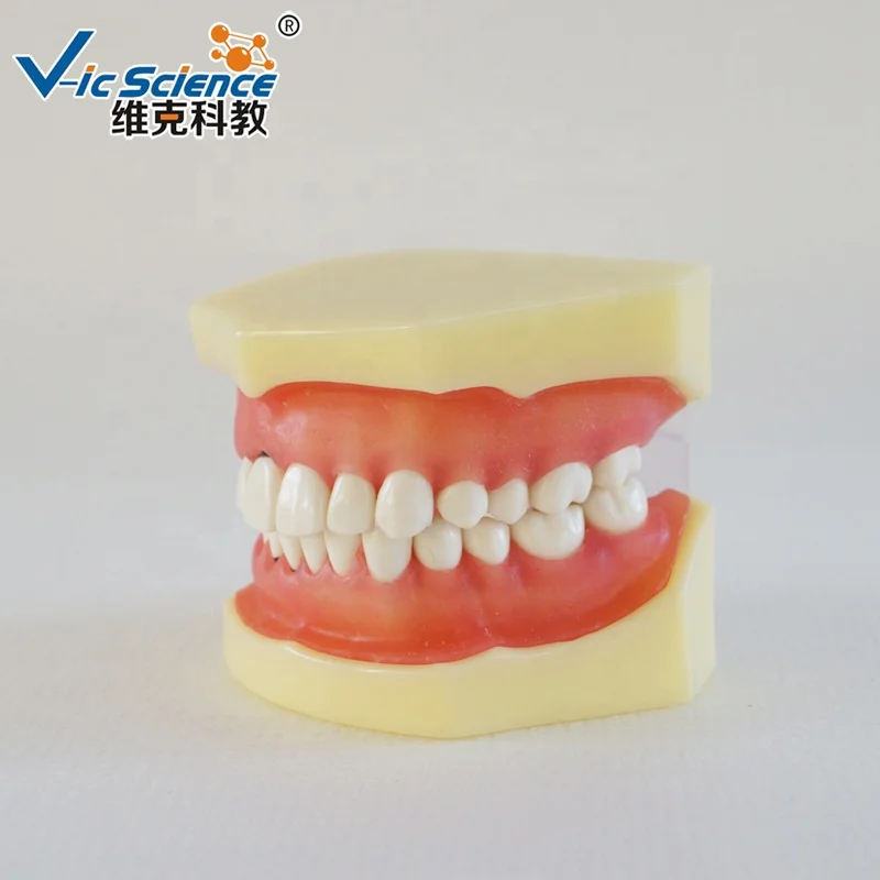 Medical Science Human Teeth Model Peridontal Disease Model Dental ...