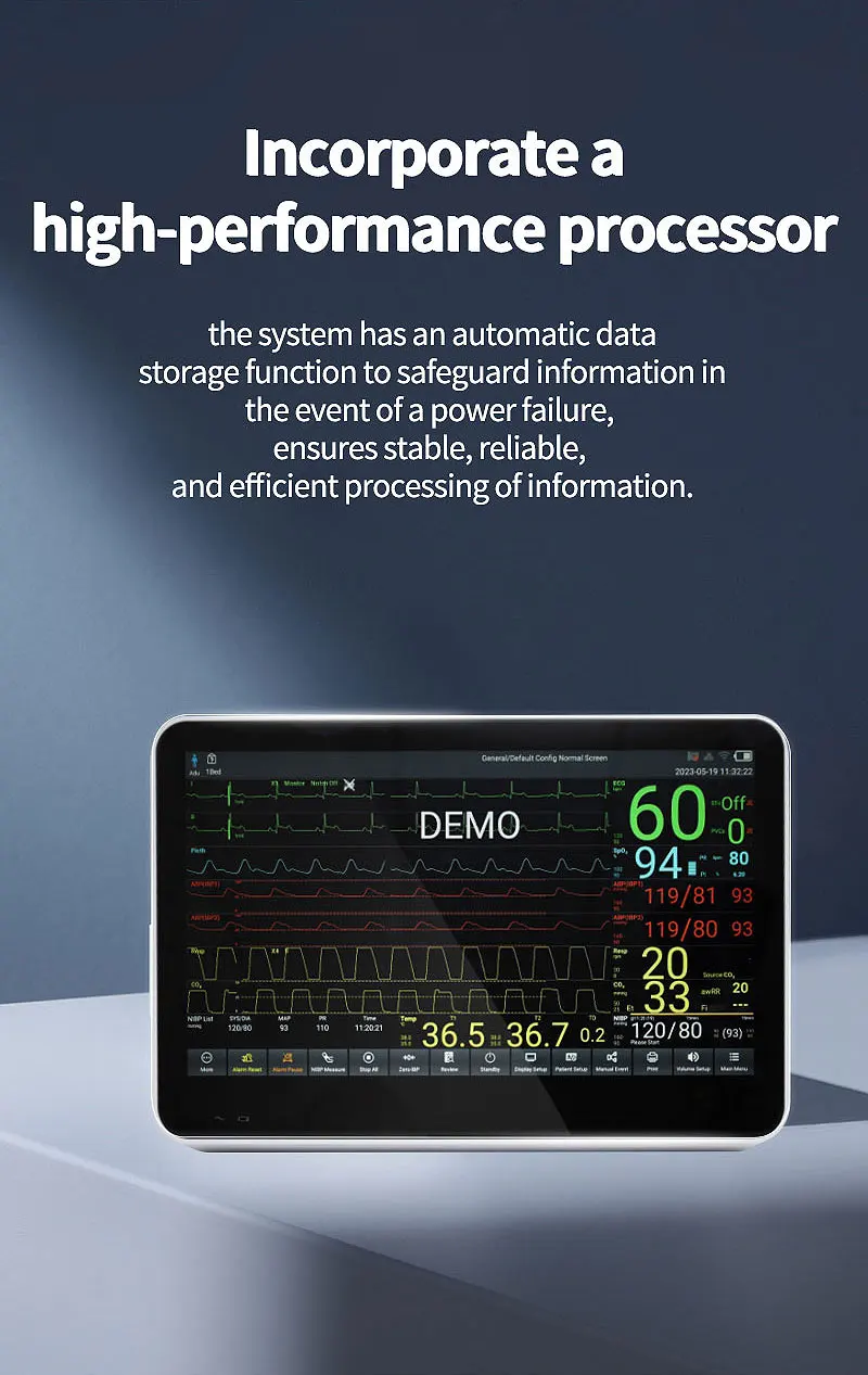 CONTEC CMS8500 - Versatile Multiparameter Vital Sign Monitor