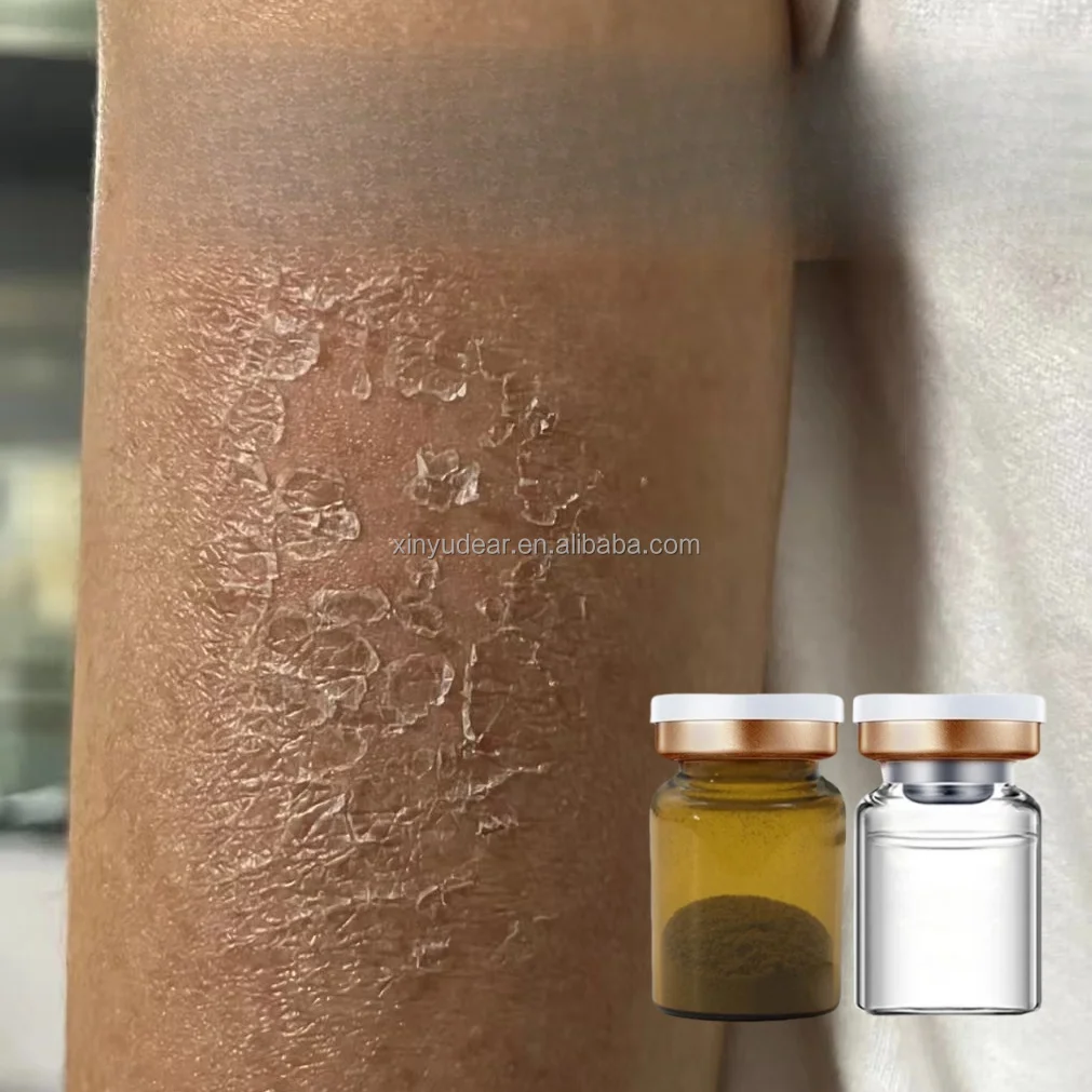 40% Spongilla Spicules Bio Spicule Microneedling Spicule Peeling ...