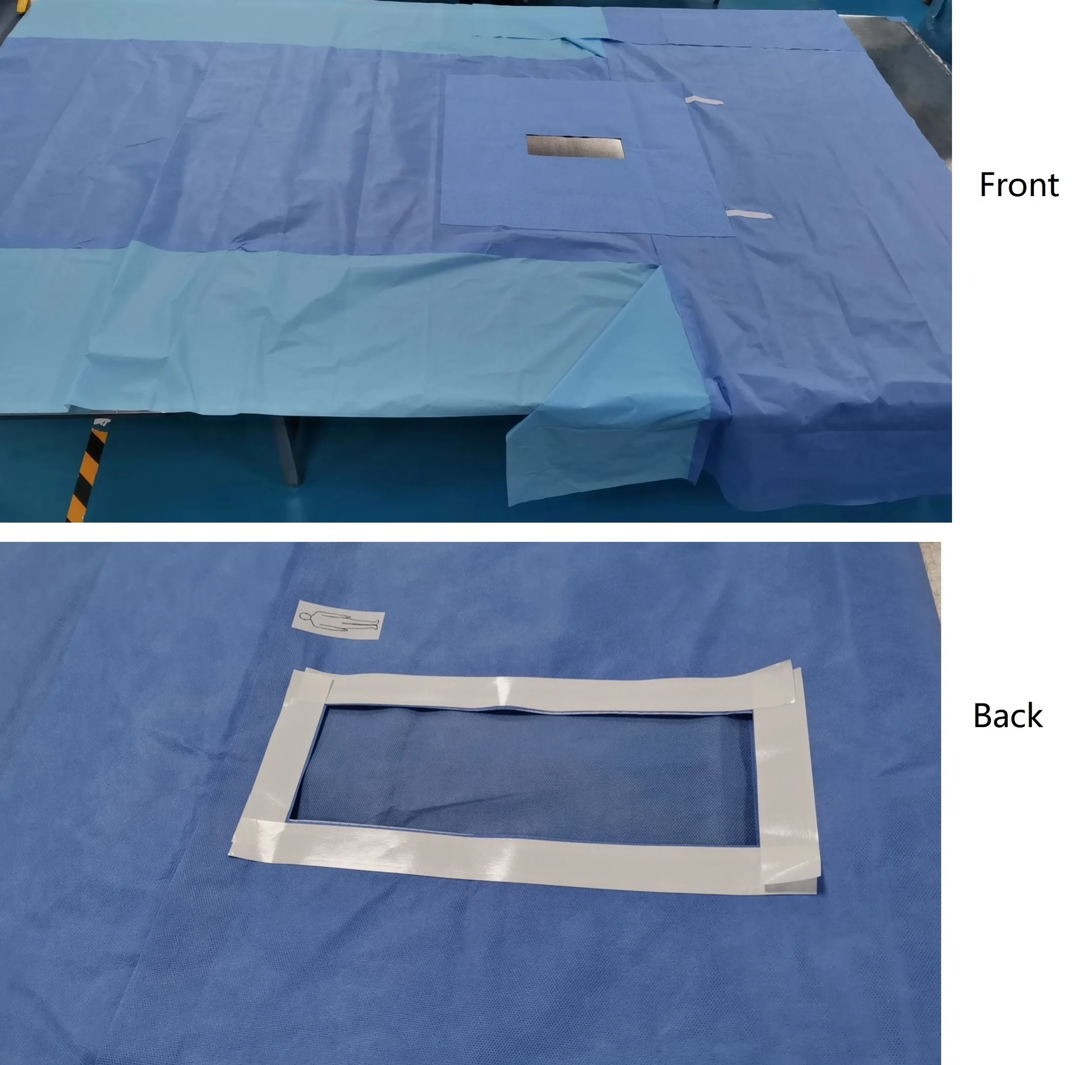 Disposable Laparotomy Drape Packs for Veterinary Surgery