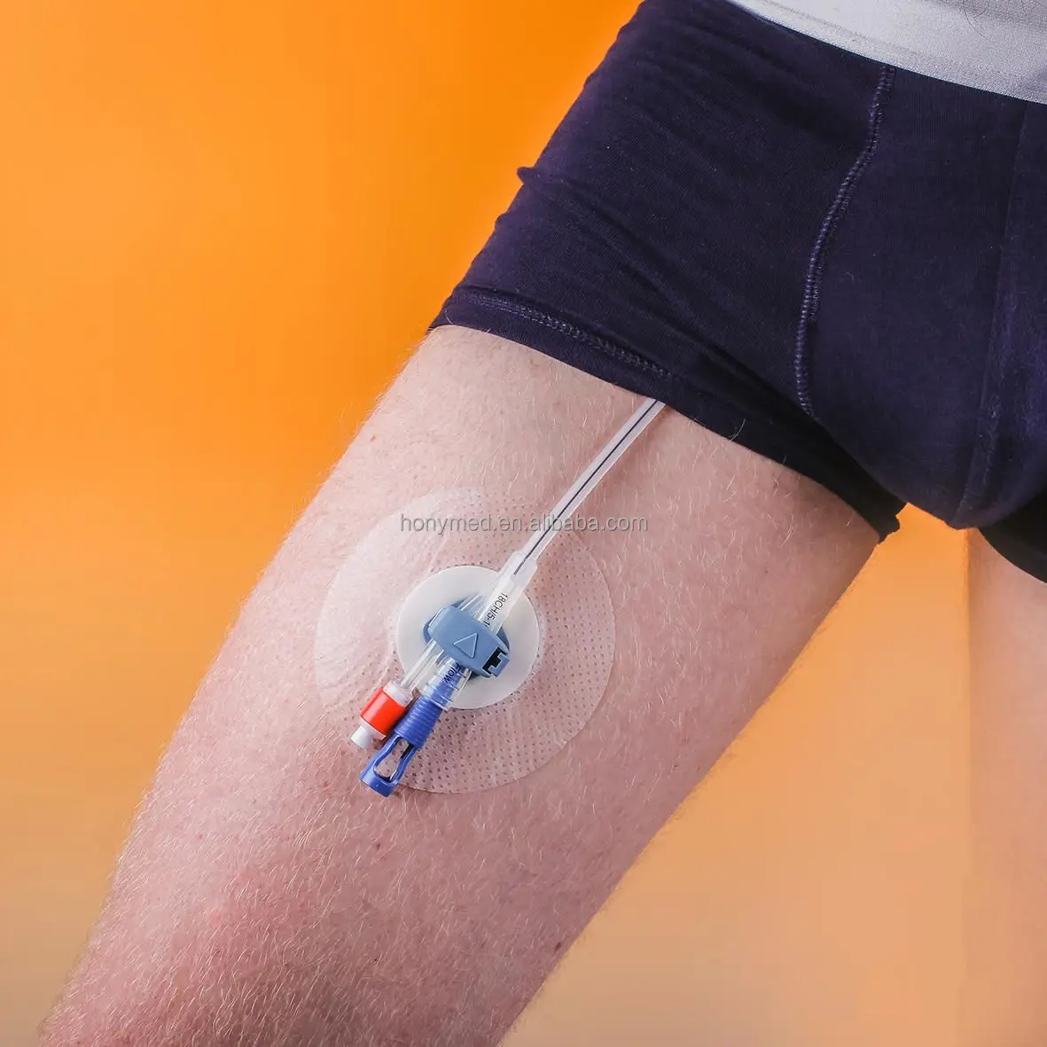 Foley Stabilization Device-gentle and Flexible| Alibaba.com