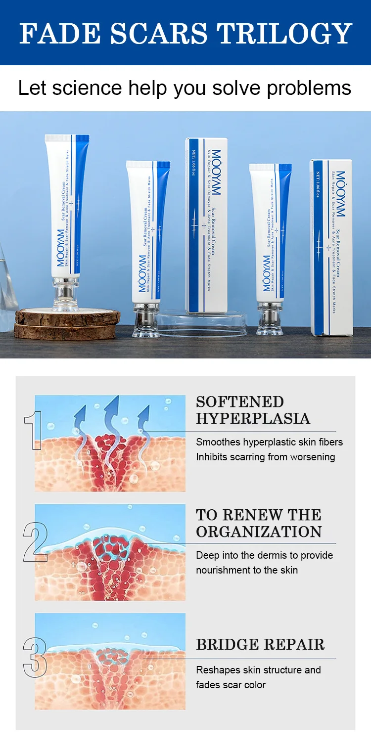 Strong Effective Acne Scar & Pimple Removal Face Gel Stretch Mark Tummy ...