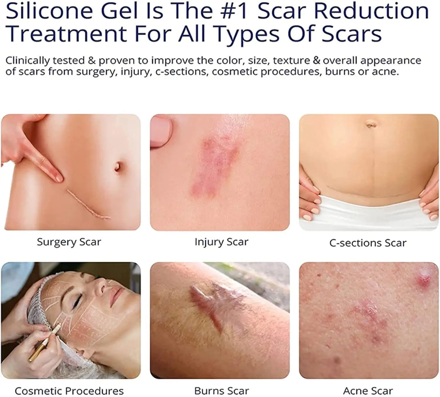Alibaba.com: Lance Advanced Silicone Scar Gel 100% silicone, suitable ...