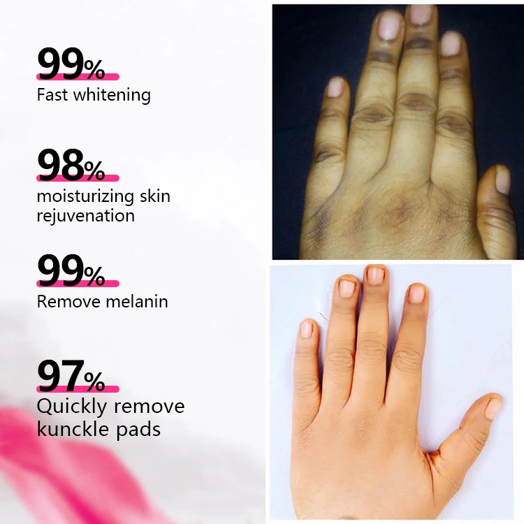 Factory Oem Black Skin Knuckles Serum Ultra White For Removing Dark ...