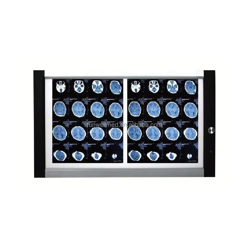 X-ray LED Portable X-ray LED Film Viewer Supplier Led X-Ray Medical x ...