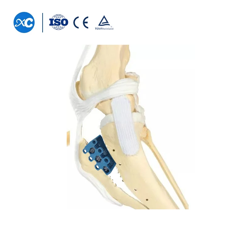 Veterinary Orthopedic Surgical Titanium Implants 3d Printing Fusion ...