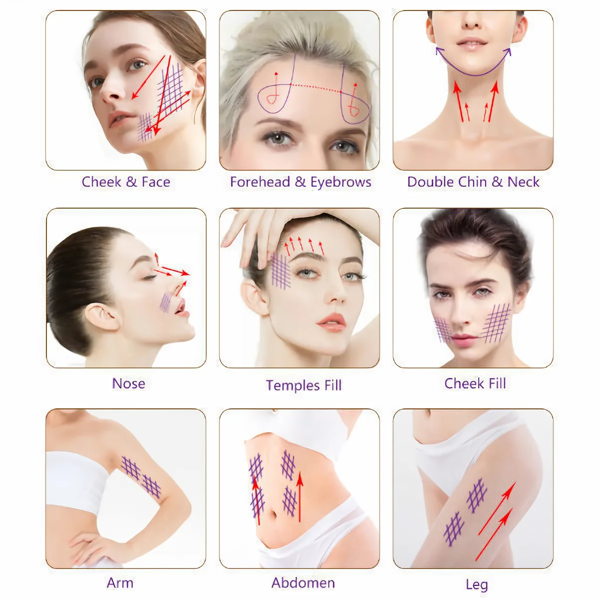 Face Lifting Cog Pod Thread Nose Tornado Thread With More Collagen ...