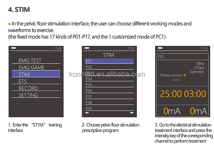 Ce Iso13485 Approved Latex Free Biocompatible Ems Tens Conductive ...