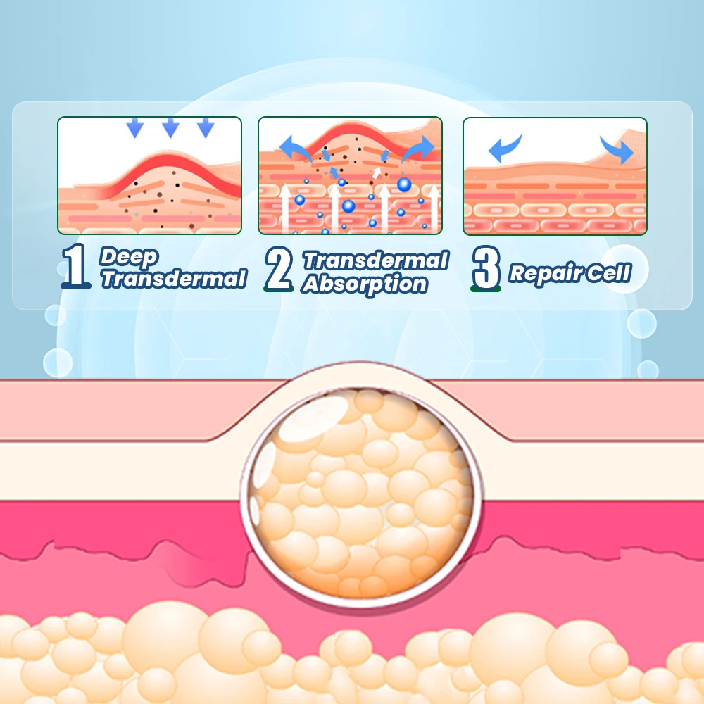 SUMIFUN Natural Herbal Fat Lump Removal Lipoma Lumps Removal Patch Anti ...