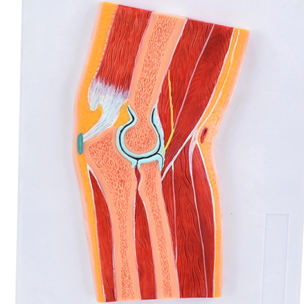 Human Section Through The Elbow Model Natural Size Medical Teaching ...