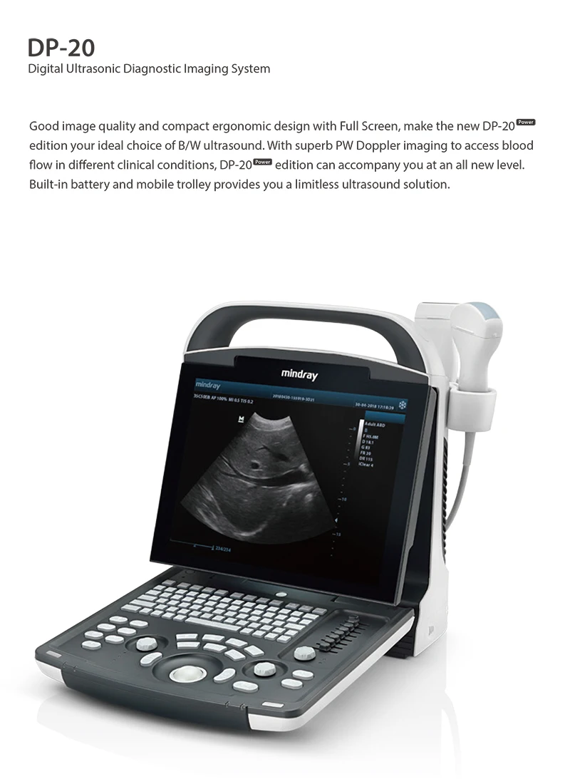 Mindray DP-10 Portable Doppler Ultrasound Machine - 10.1” Display, 1 ...