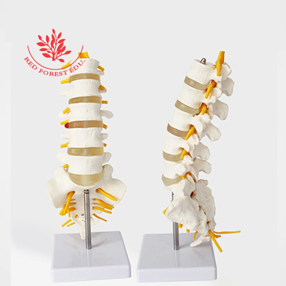 Anatomical Model of Lumbar Vertebrae & Sacrum - Medical Education OEM