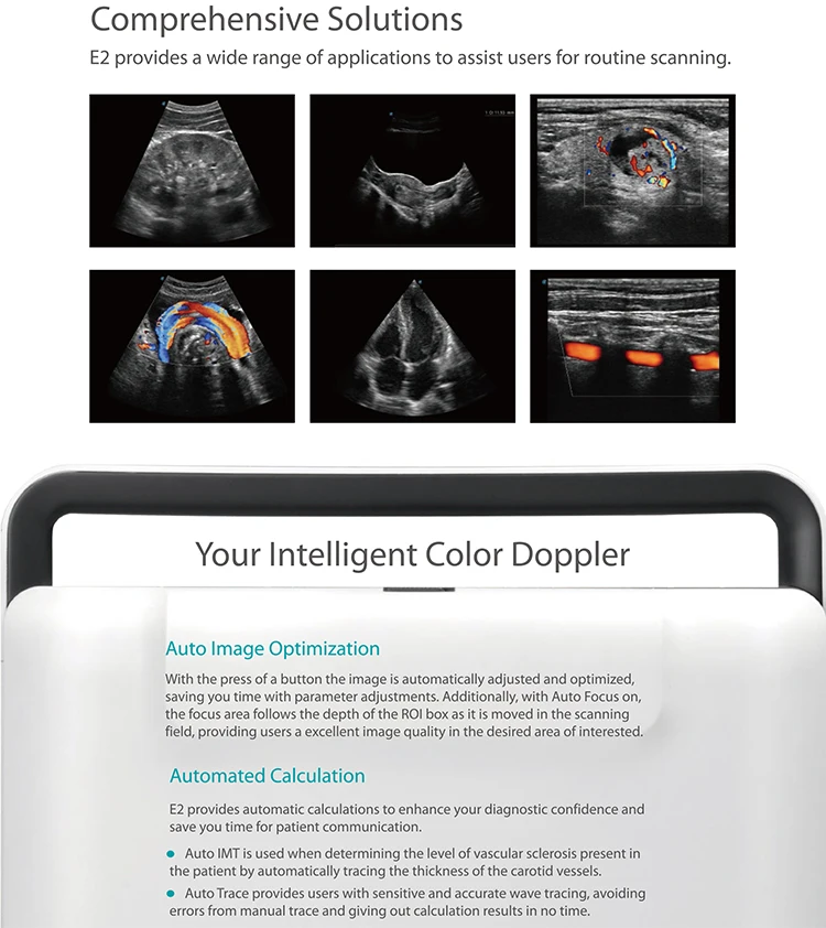 Sonoscape E2 Ultrasound Machine - Portable and Versatile