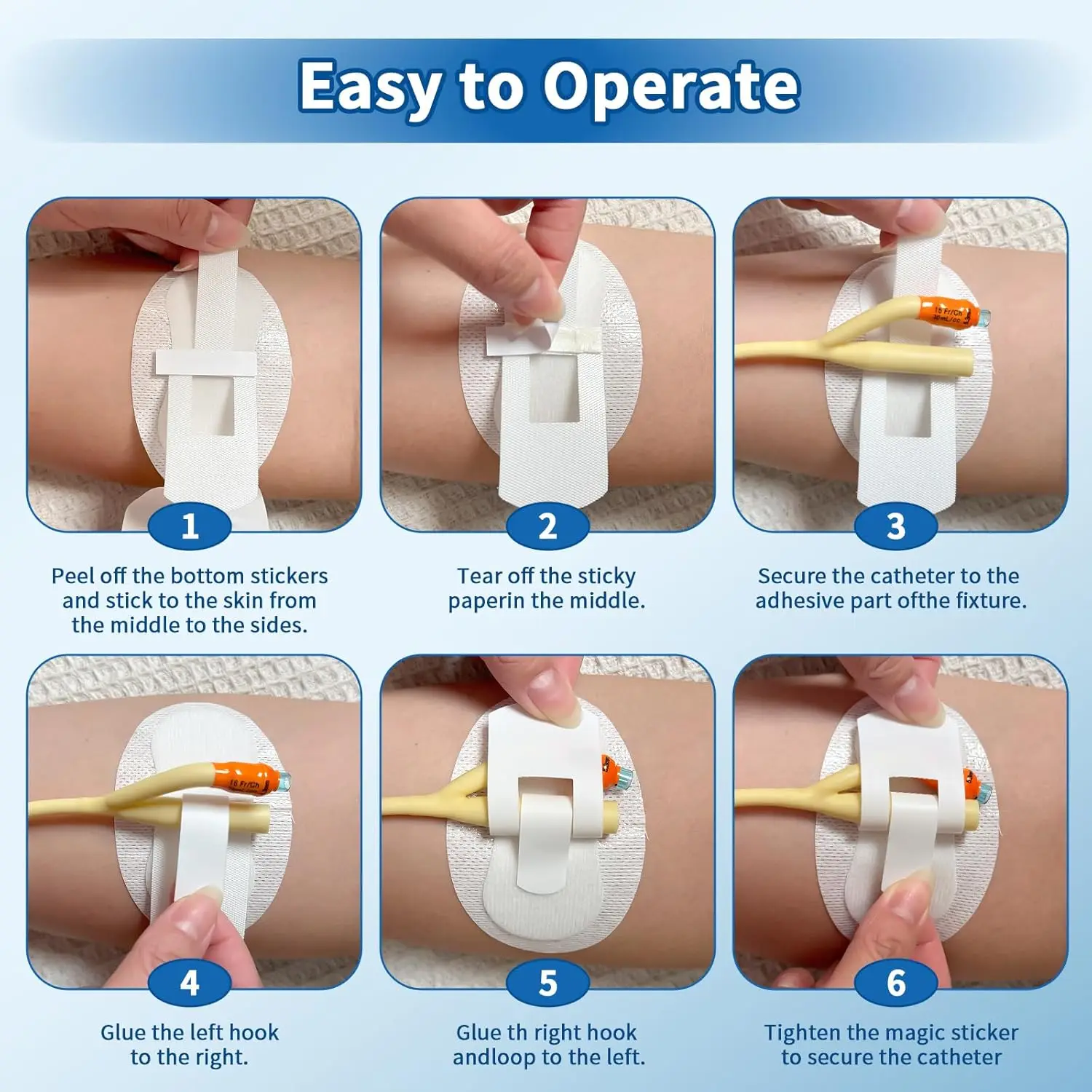 Non Woven FIXING Dressing - Catheter Stabilization Device