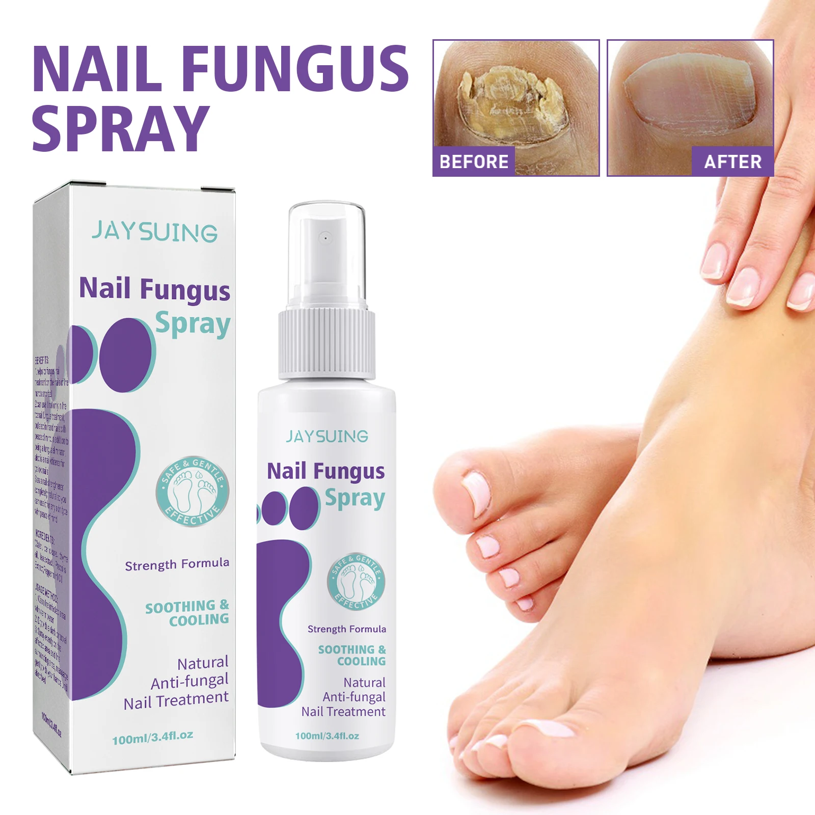 Jaysuing Gray Nail Care Spray for Ingrown Nails Yellowing Thickening ...