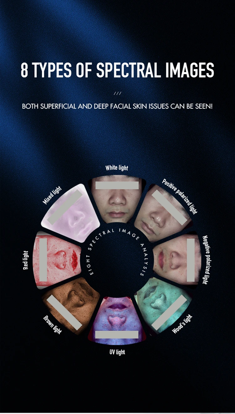 Artificial Intelligence Skin Detector Analyzer Device 3D Facial Skin ...