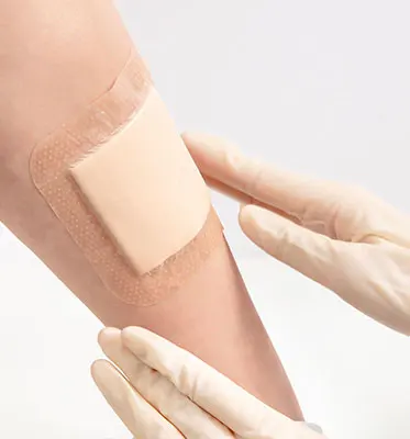 Sterile Wound Dressing Silicone Foam Dressing Has High Absorption