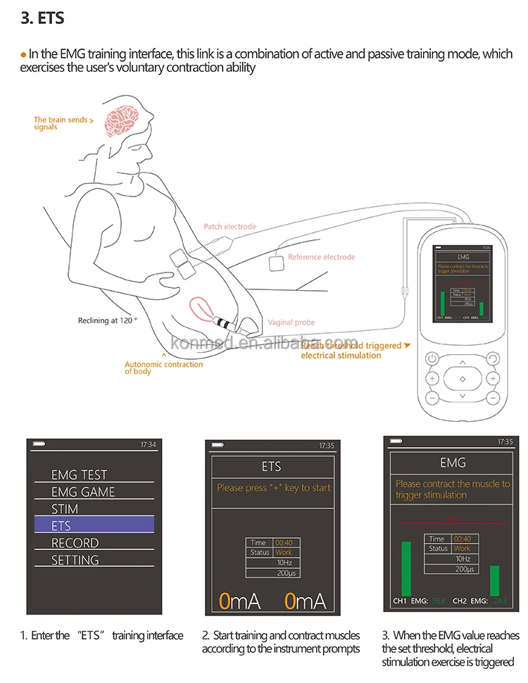 Biofeedback Kegel Toner - Relieve Pelvic Floor Pain