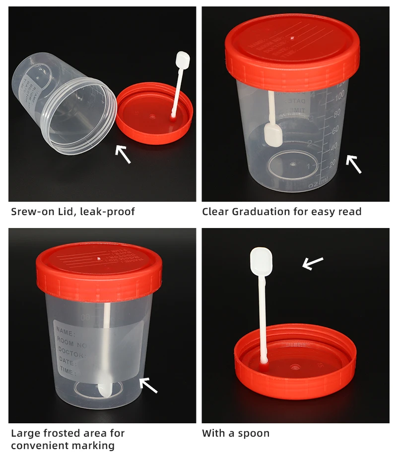 High Quality Fecal Sample Collection Tubes - Disposable