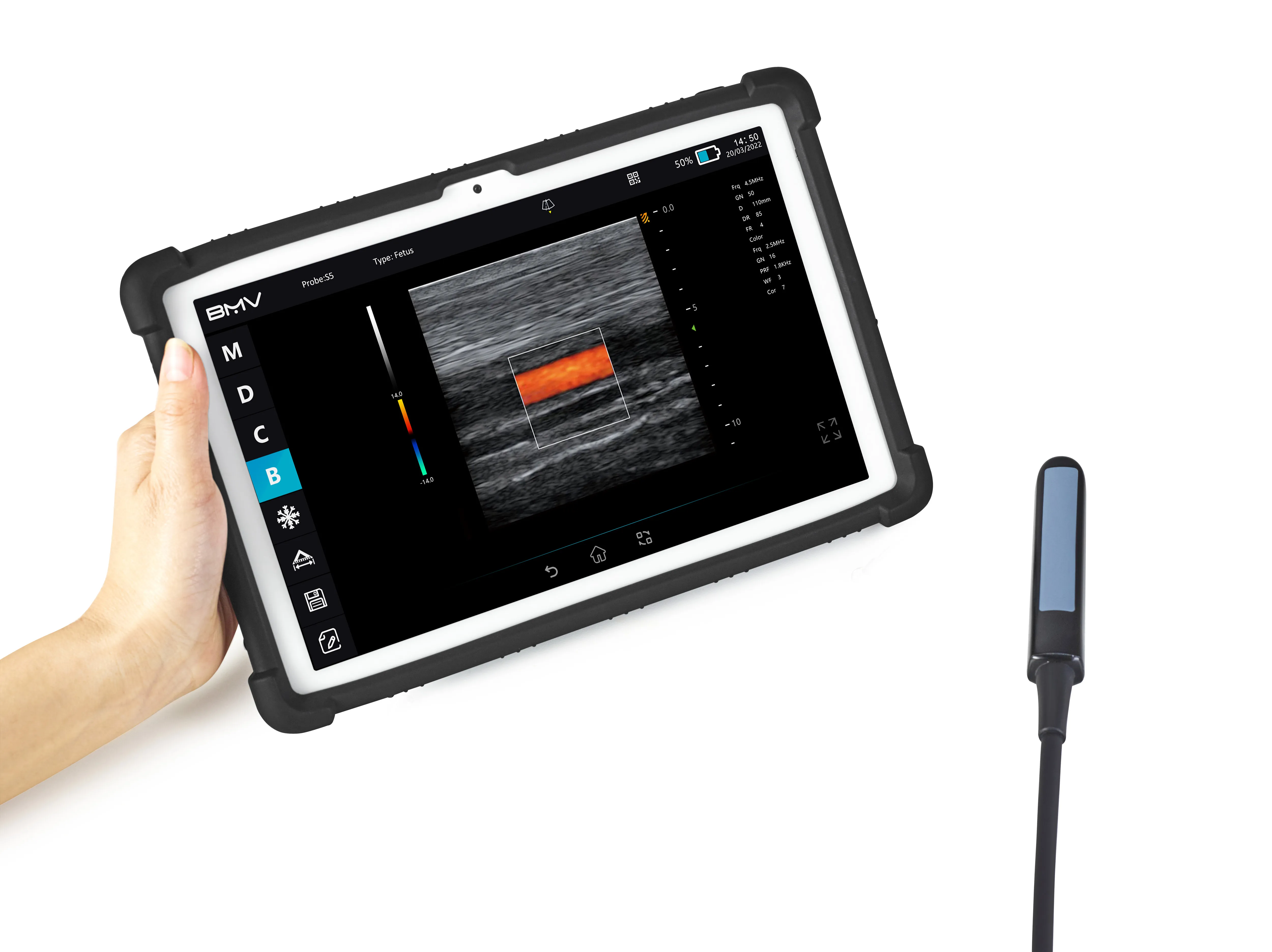 Wireless Rectal Linear Convex Probe Cattle Horse Pregnancy Diagnostic ...