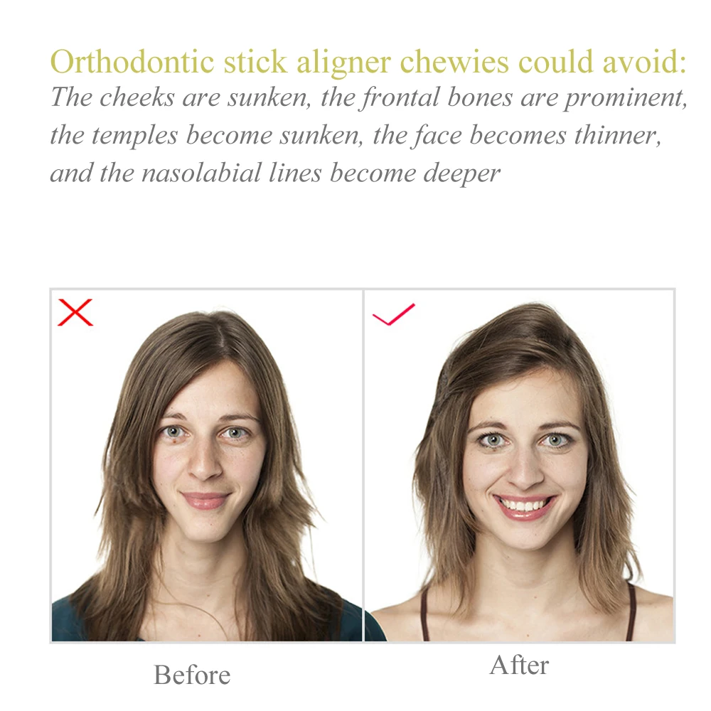 Dental Orthodontic Aligner Seater Chewies for Invisalign Trays Aligner ...