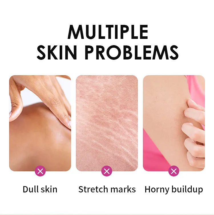 Private Label Extra Strong Peeling Oil - Scar & Stretch Mark Removal