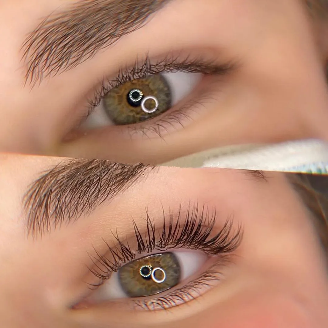 New Arrival High Quality Private Label Cysteamine Hcl Fast Solution ...