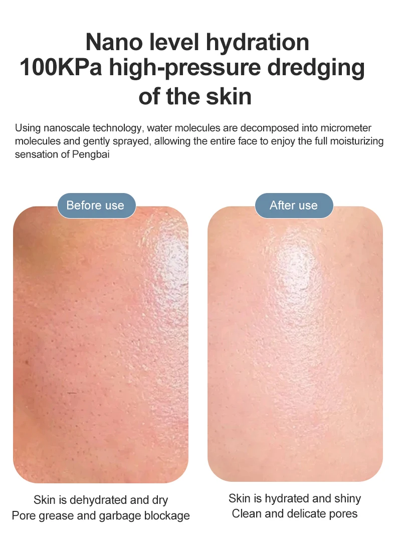 Hand Held Nano Oxygen Injector Spray Beauty Equipment Popular Skin ...