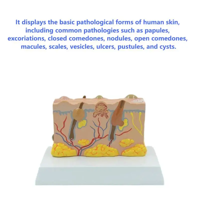 Pathological Skin Anatomical Model for Educational Equipment Human Skin ...