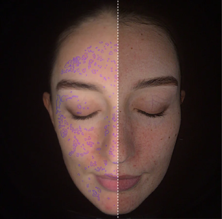 MEICET MC10 Skin Analyzer - Professional Facial Care Tool