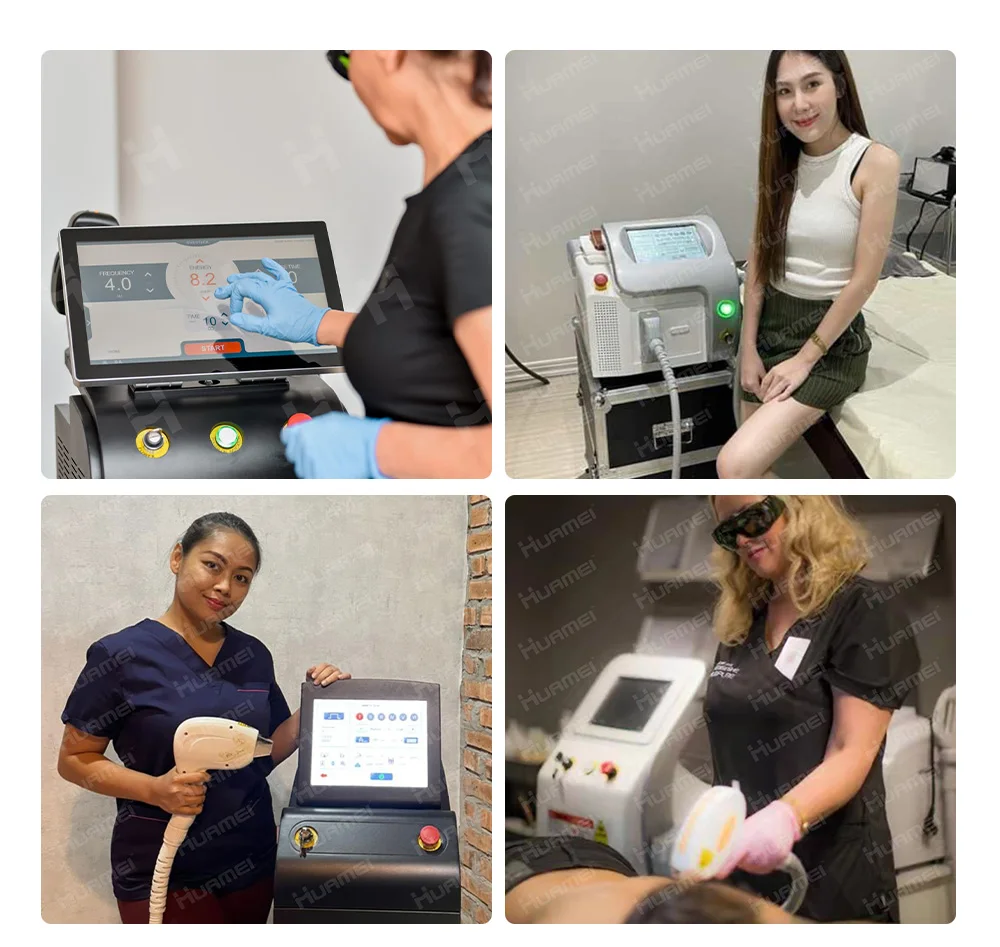 Super 808 Diode Laser Hair Removal Machine - Painless & Efficient