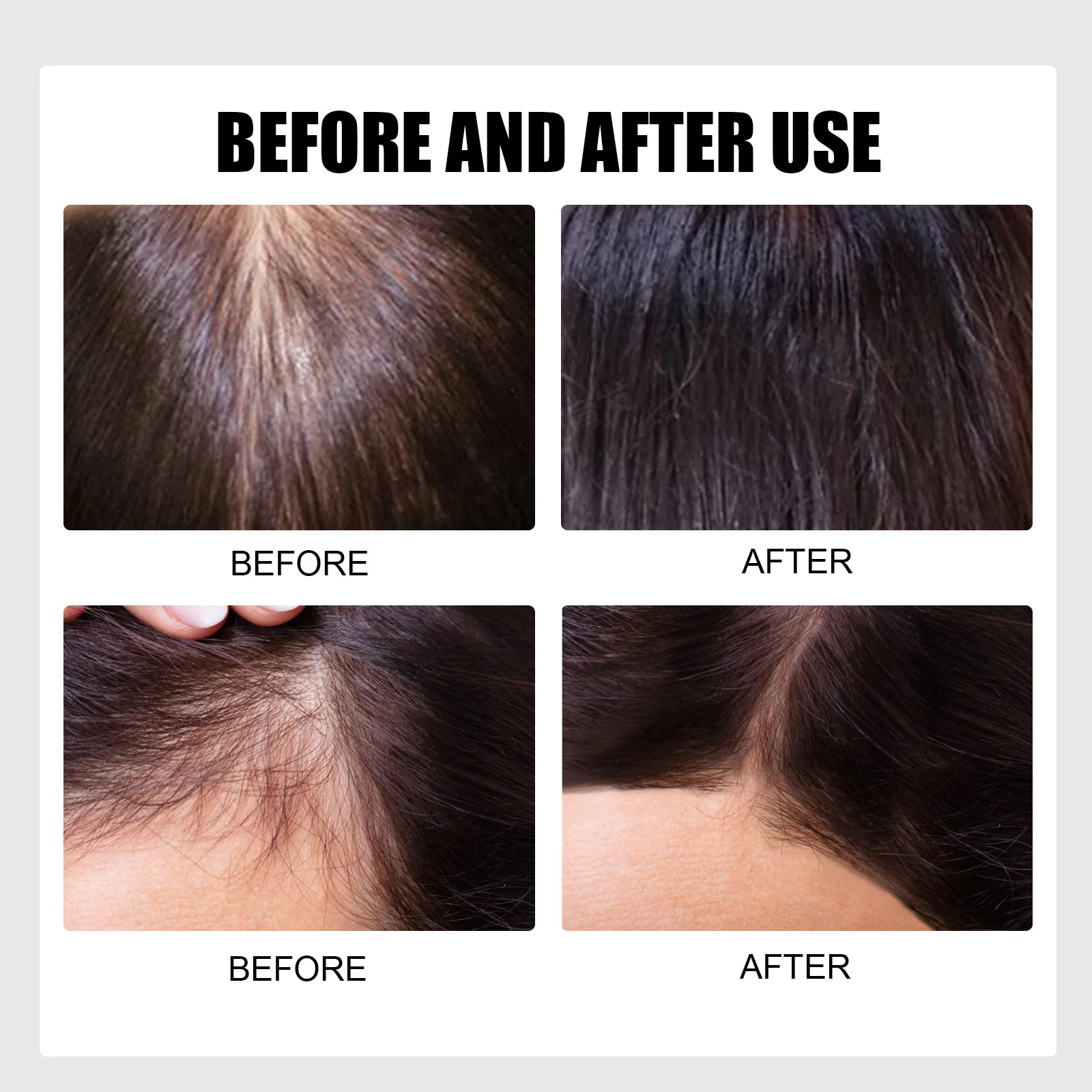 Scalp Scrub Cream Dense Hair To Prevent Scalp Dropping,Deep Cleaning ...