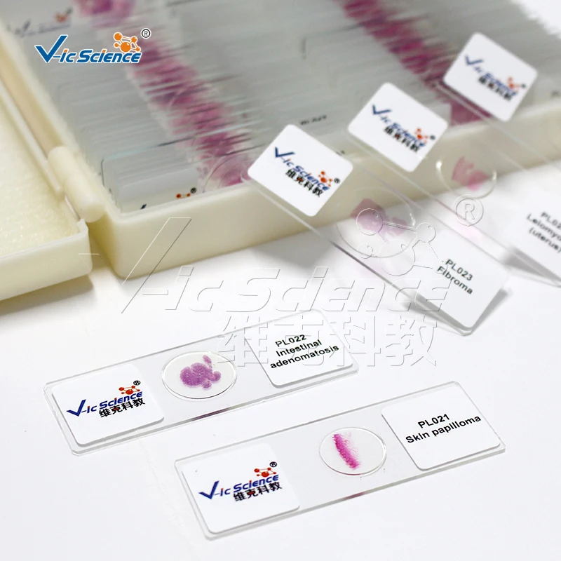 Microscope Slide of Pathology Disease Educational Slides