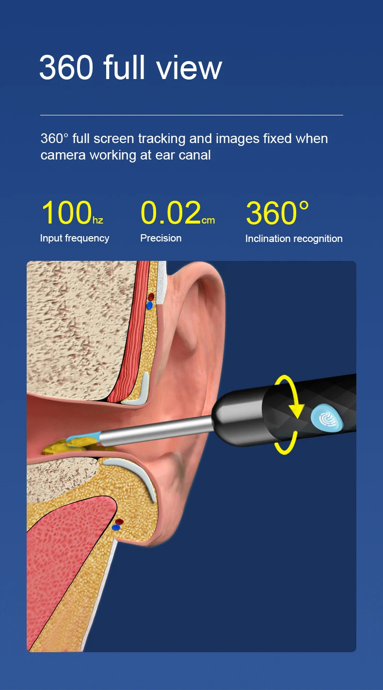 Acne Squeezing Remover Function Inskam X3 Visual Ear Spoon