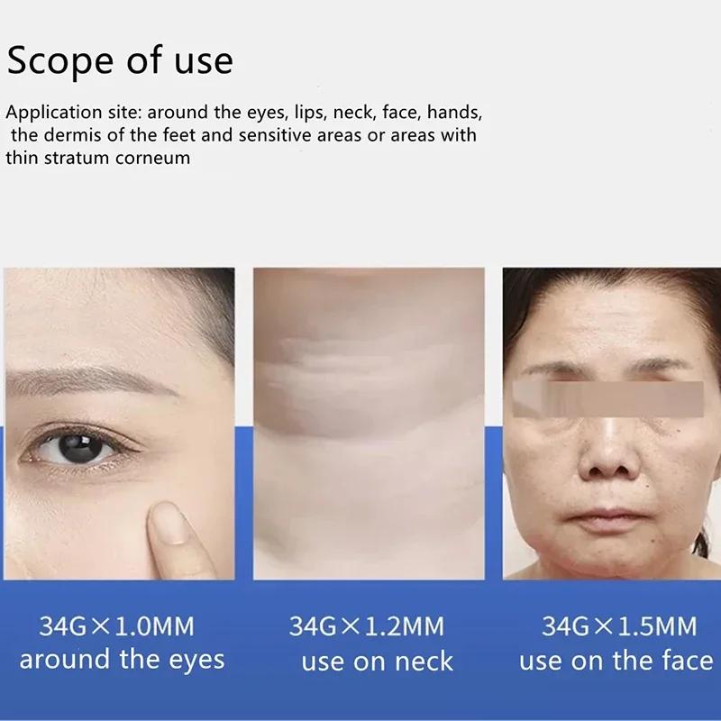 Nanosoft Microneedles Fillmed 3 Pin Needle 34g 1.0mm 1.2mm 1.5mm ...