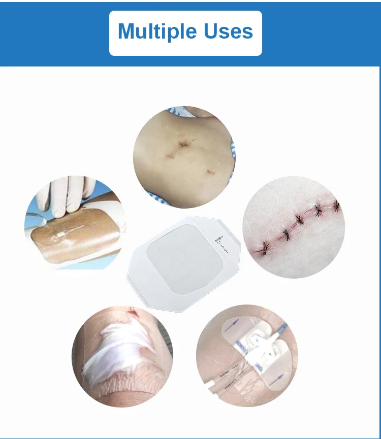 Transparent Dressing for IV Fixation - Waterproof Wound Dressing