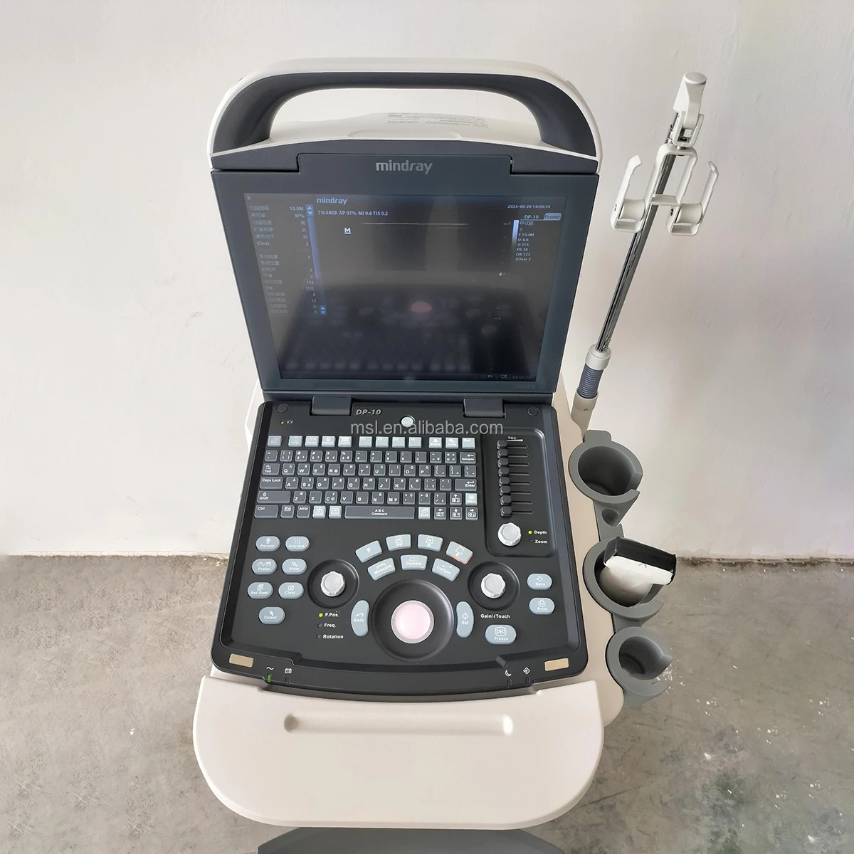 Mindray Portable Ultrasound - Reliable Diagnostic Tool