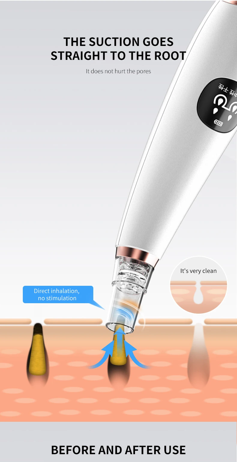 Pimple Sucker 2022 Pore Cleaner Electric Black Head Vacuum Suction ...